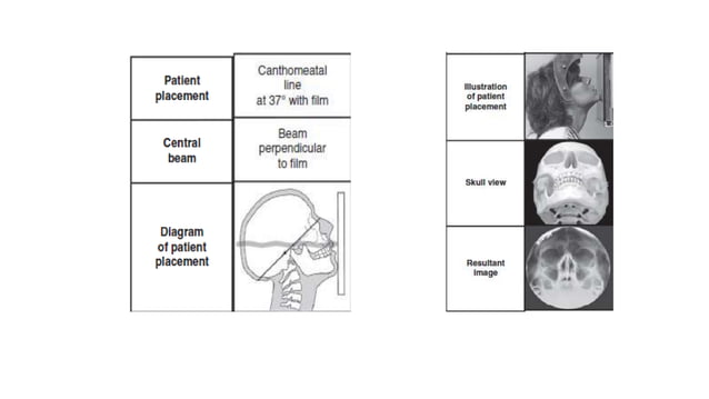 Waters projection | PPTX