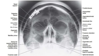 Waters projection | PPTX