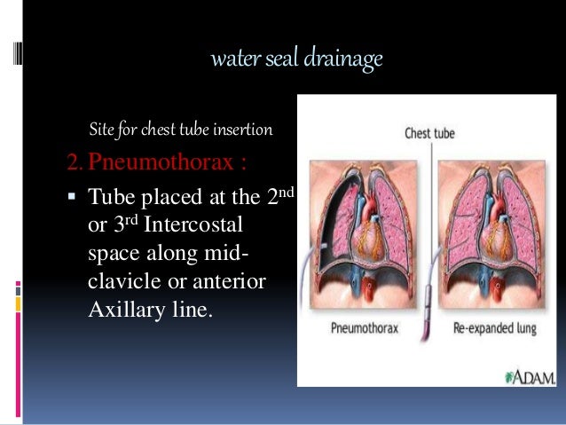 Water seal drainage