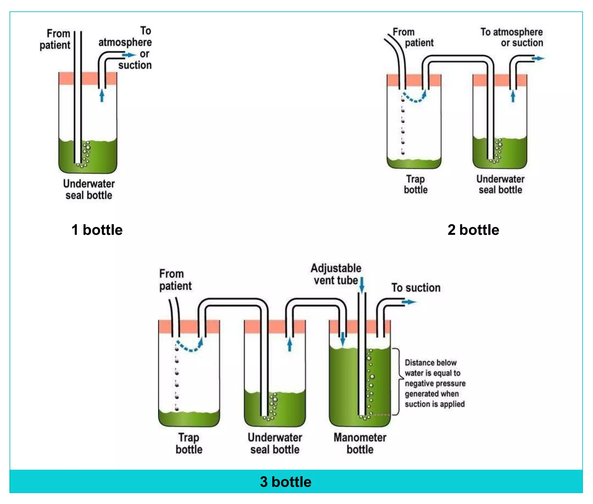 Water seal drainage | PPTX