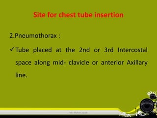 Water seal drainage | PPTX