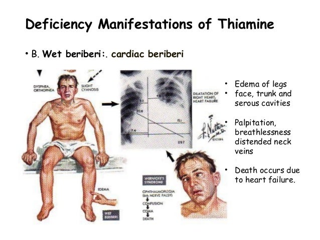 Water soluble vitamins