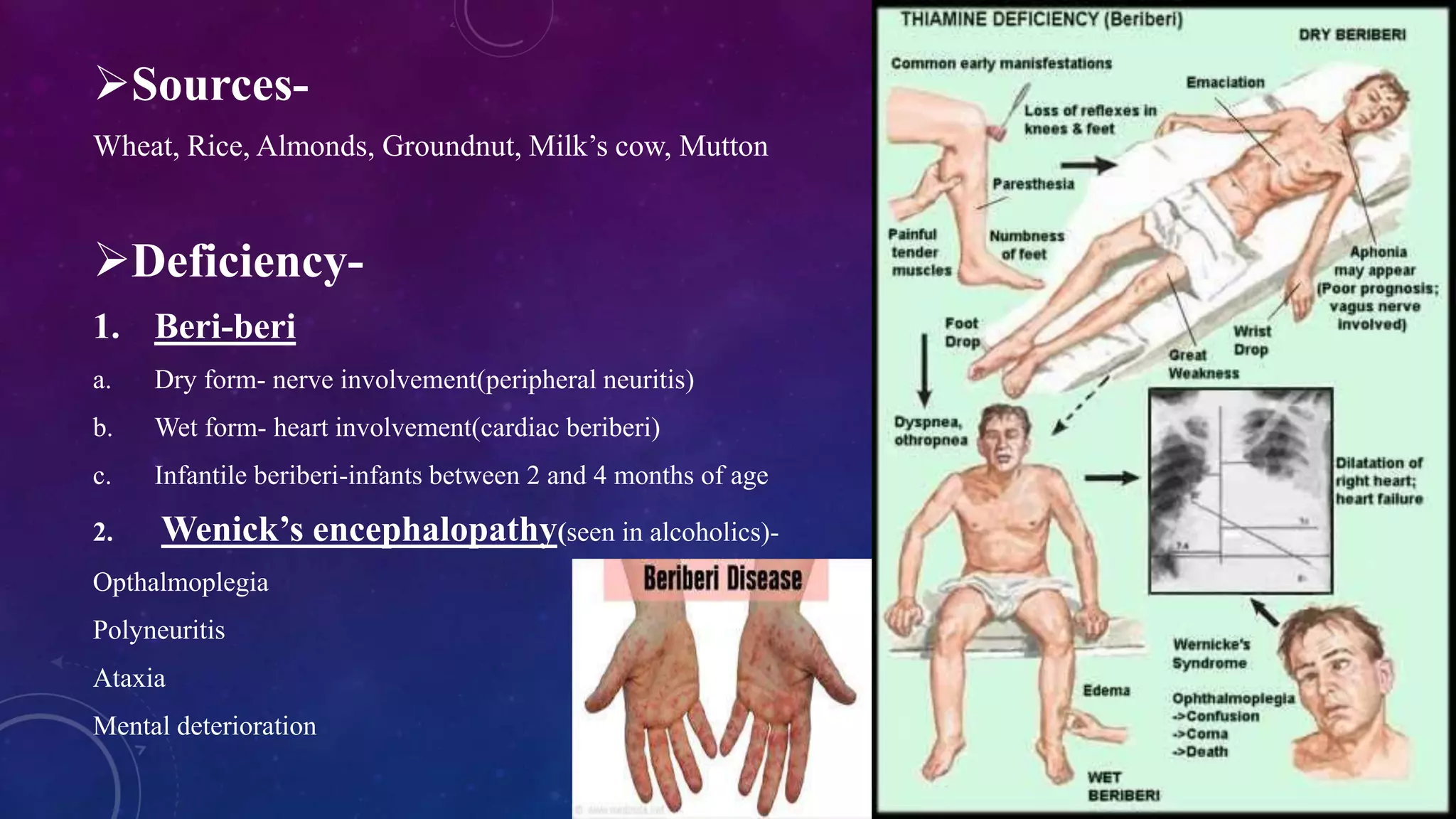 Water soluble Vitamins.pptx
