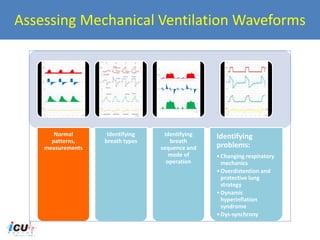 Waveform asessment | PPT