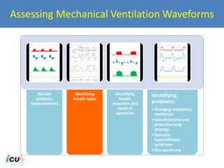 Waveform asessment | PPT