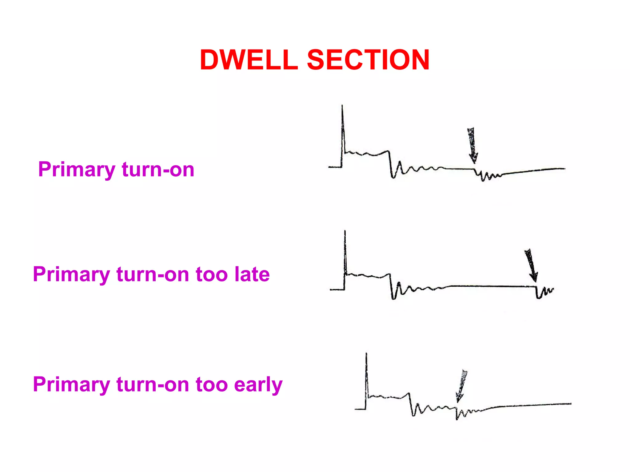 Waveform ignition | PPT