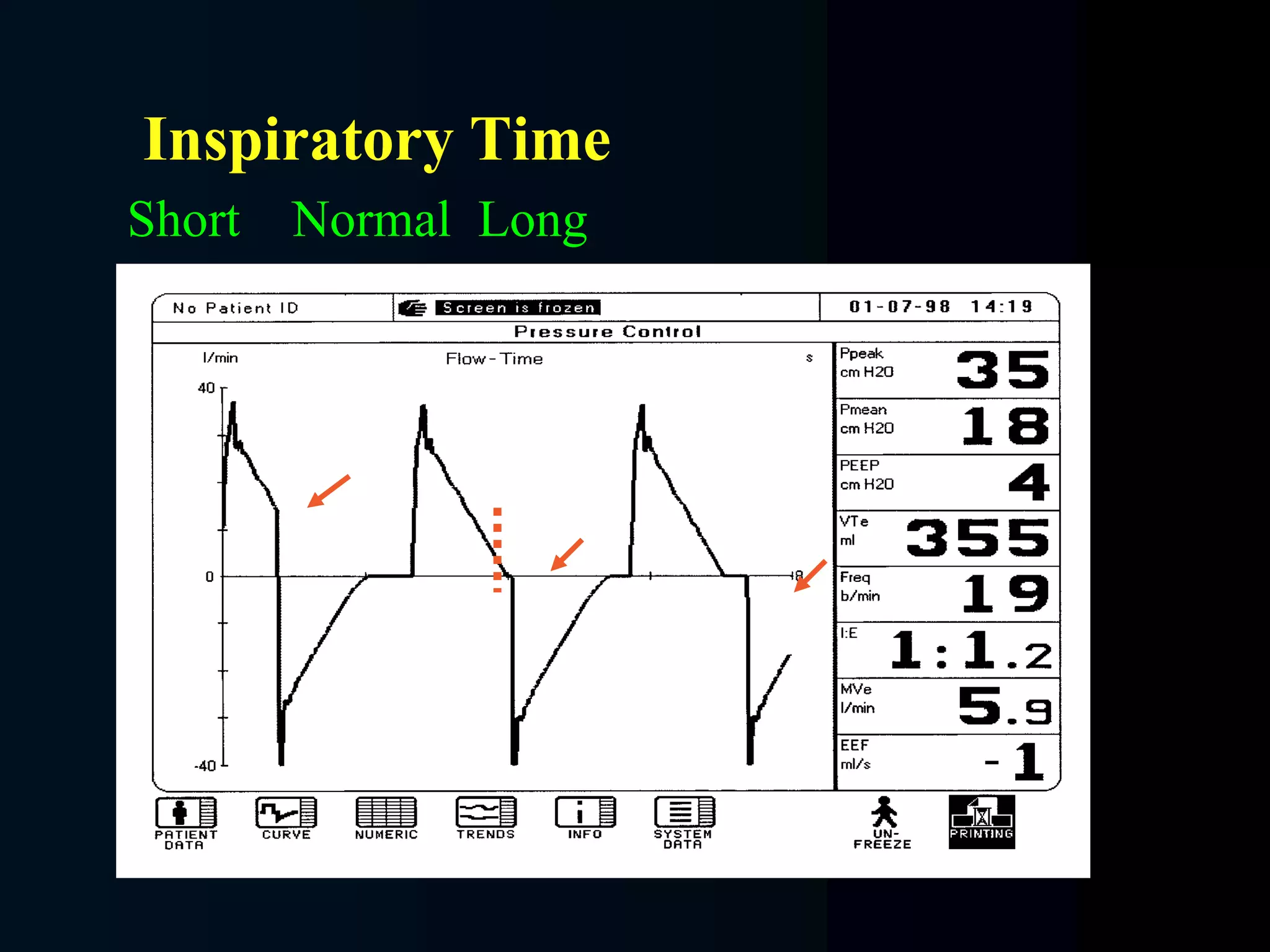 Waveforms, lecture about mechanical ventilation, by Prof Ahmed Tarek ...