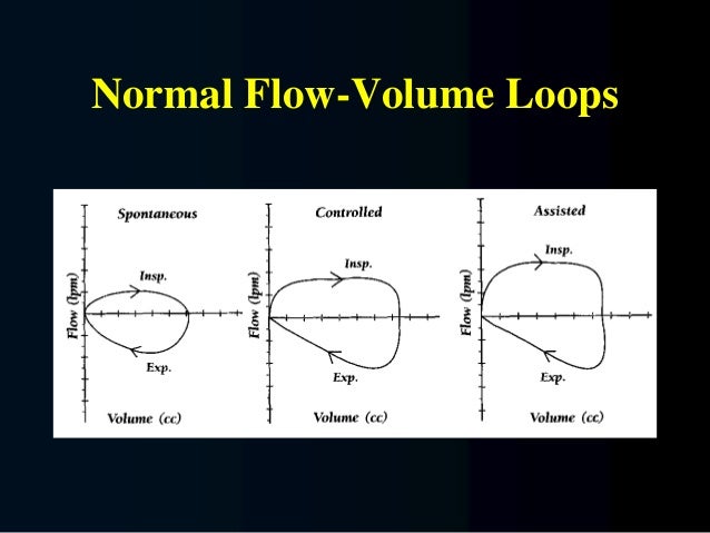 Waveforms, lecture about mechanical ventilation, by Prof Ahmed Tarek,…