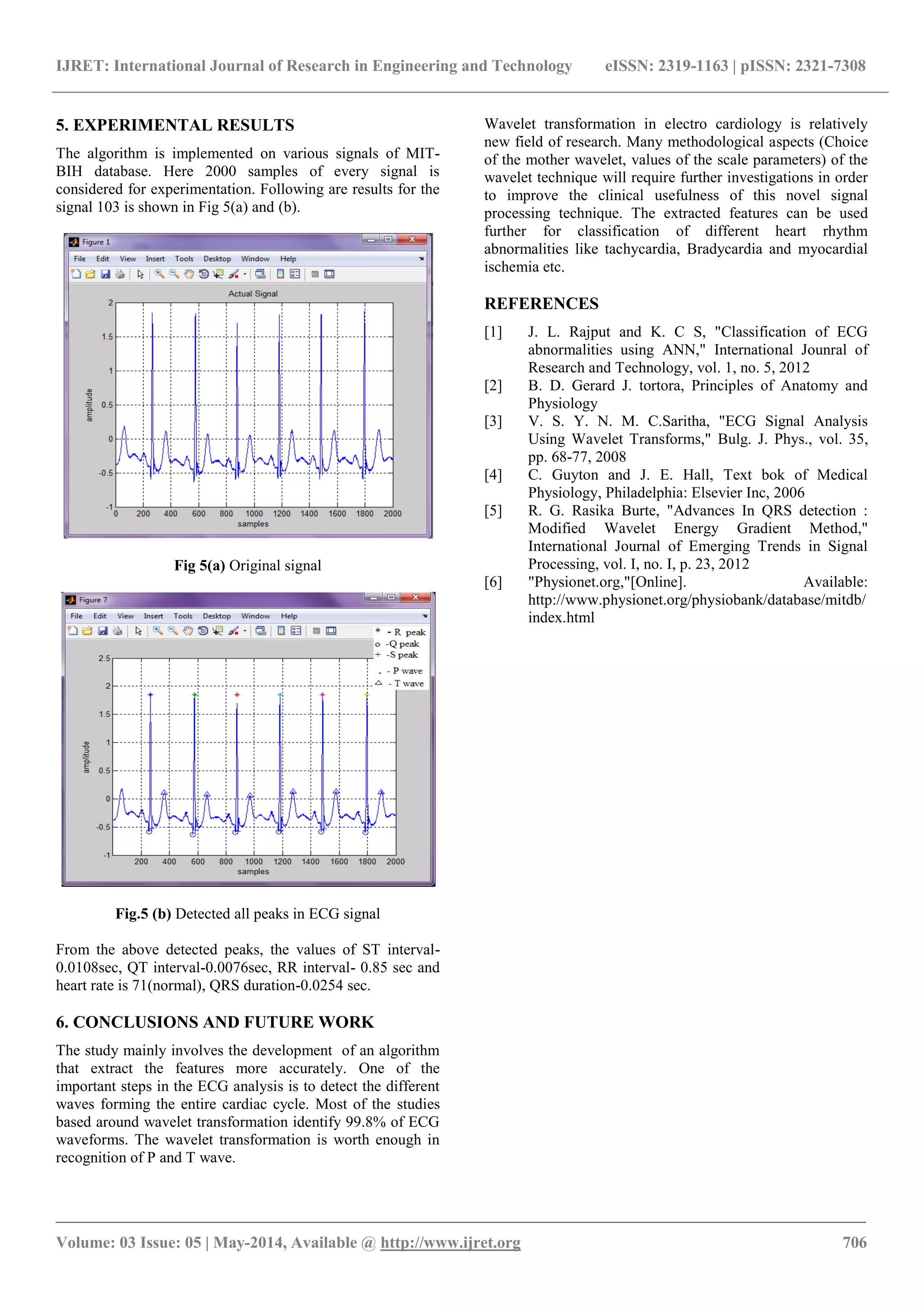 Wavelet Based Ecg Signal Component Identification Pdf