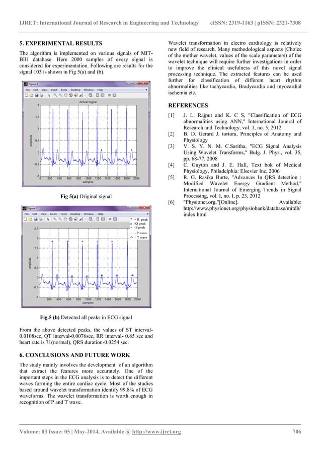 Wavelet based ecg signal component identification | PDF | Heart and Cardiovascular Diseases ...