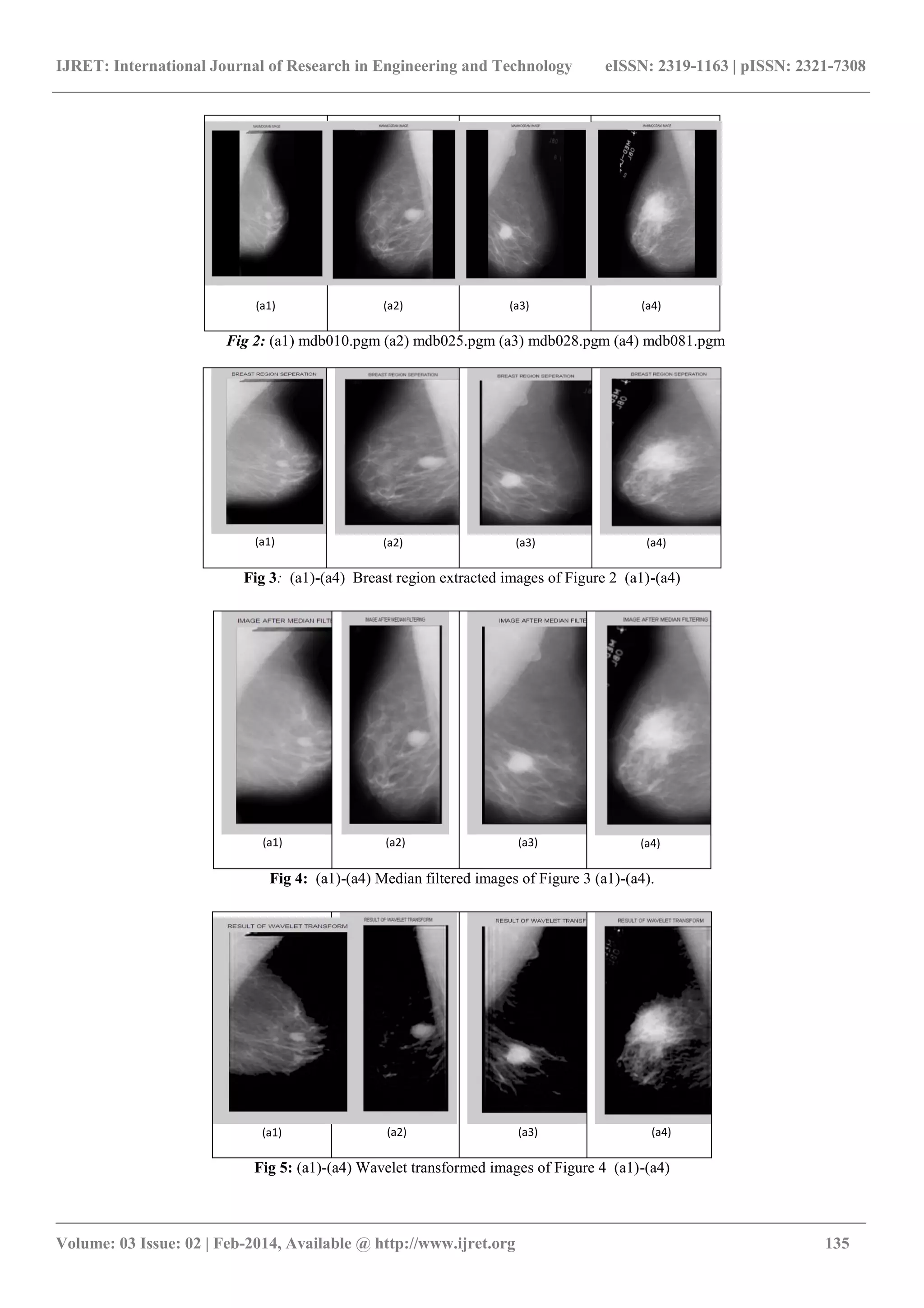 Wavelet Transformation Based Detection Of Masses In Digital Mammograms