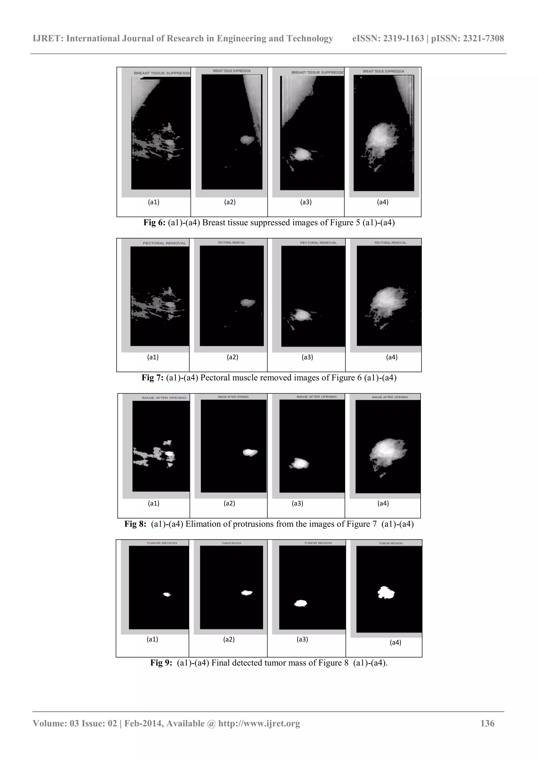 Wavelet Transformation Based Detection Of Masses In Digital Mammograms