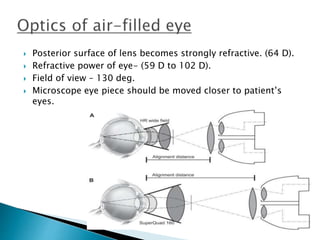 Wide angle viewing system | PPTX
