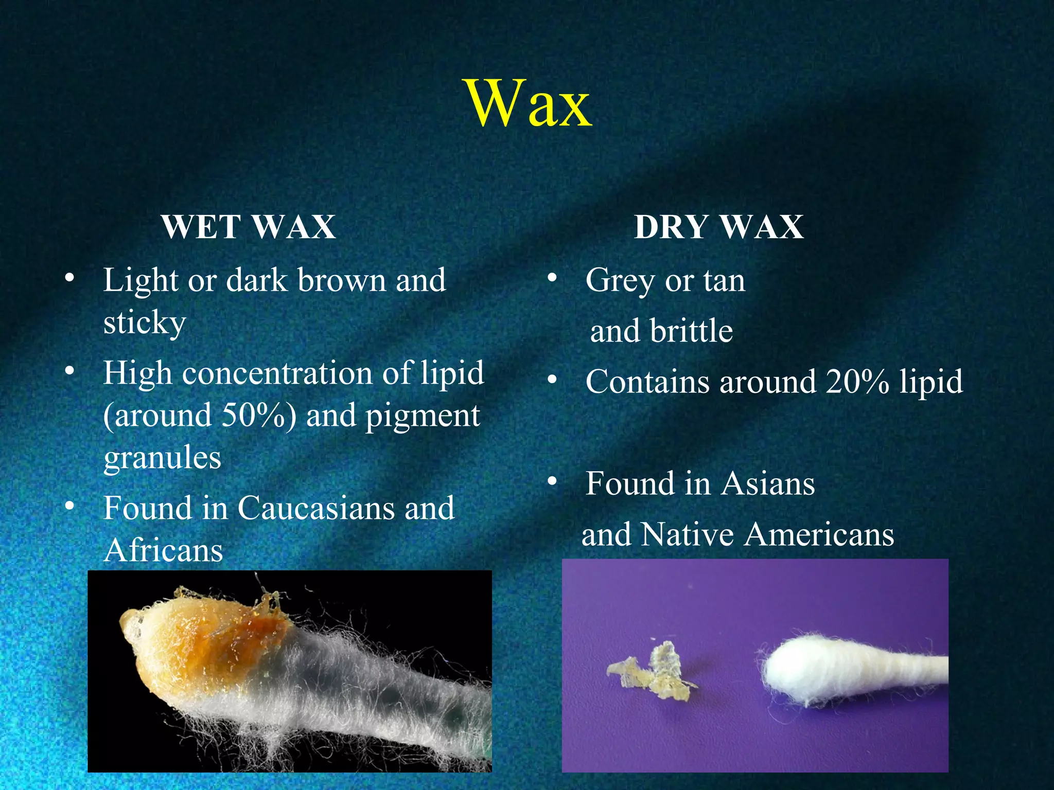 Ear Wax and syringing | PPT