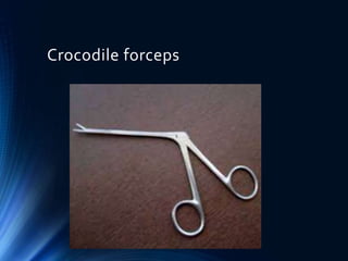 Wax and Foreign body ear | PPTX