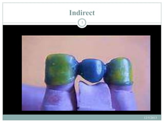 Waxes (thermoplstics) in dentistry | PPT