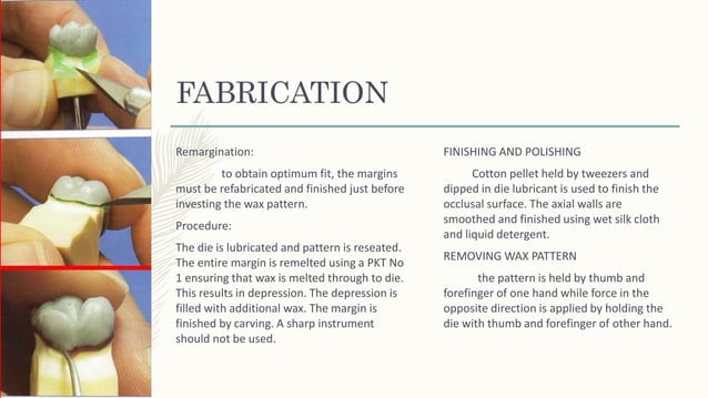 Wax pattern | PPTX | Dental Health | Diseases and Conditions