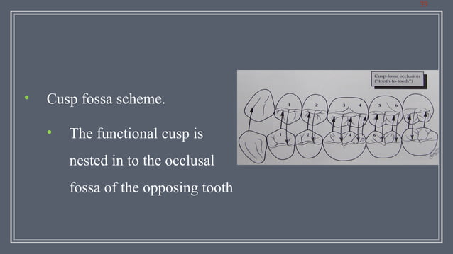 wax pattern, Esthetic and Occlusal Considerations | PPT