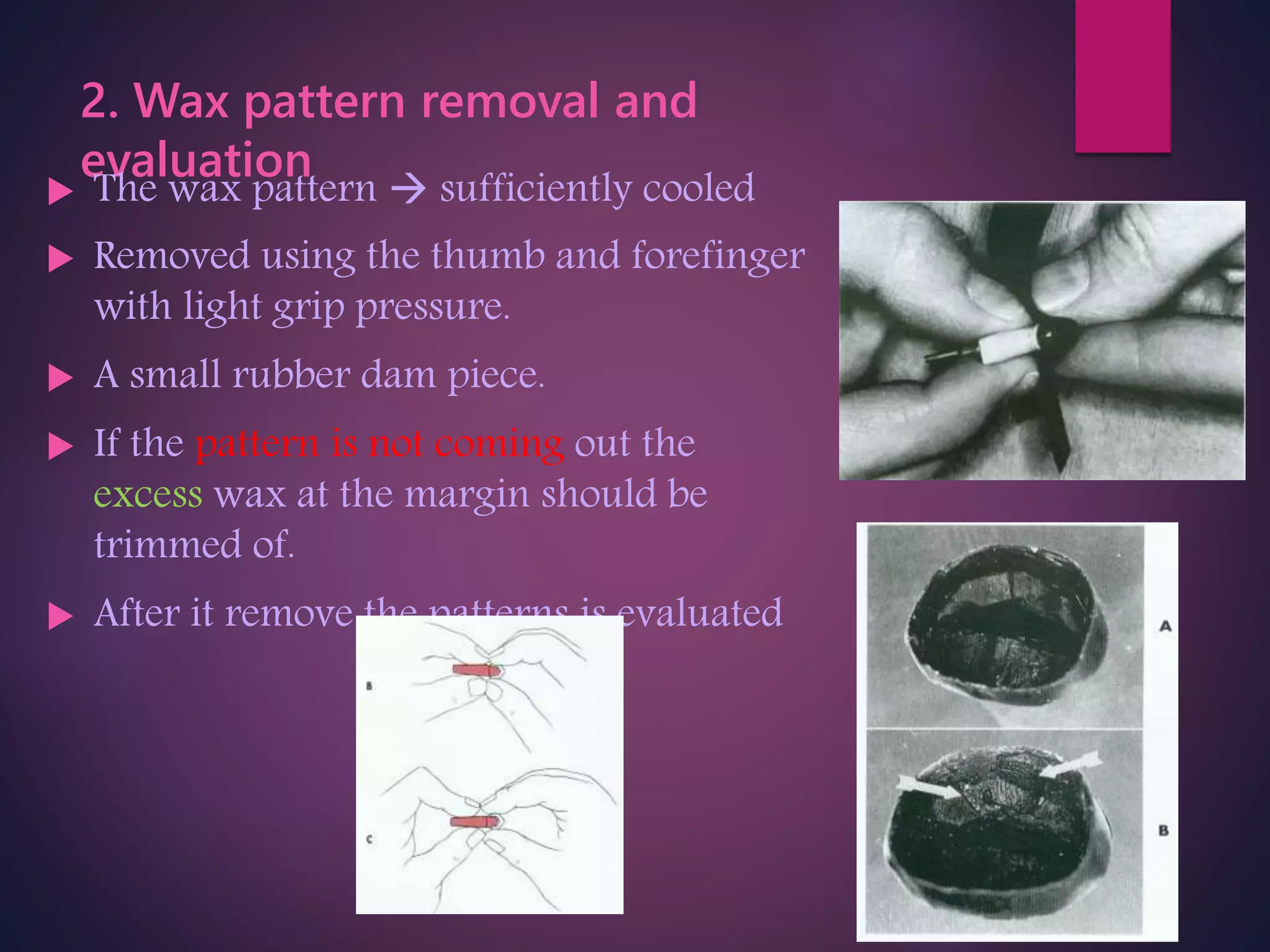 Wax patterns fabrication for fixed partial dentures | PPTX