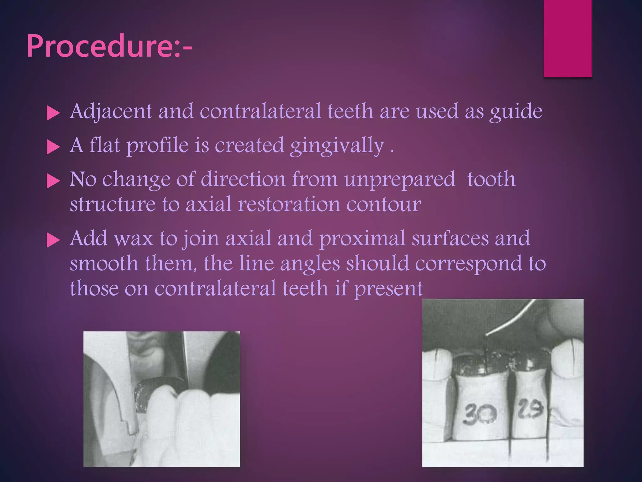 Wax patterns fabrication for fixed partial dentures | PPTX