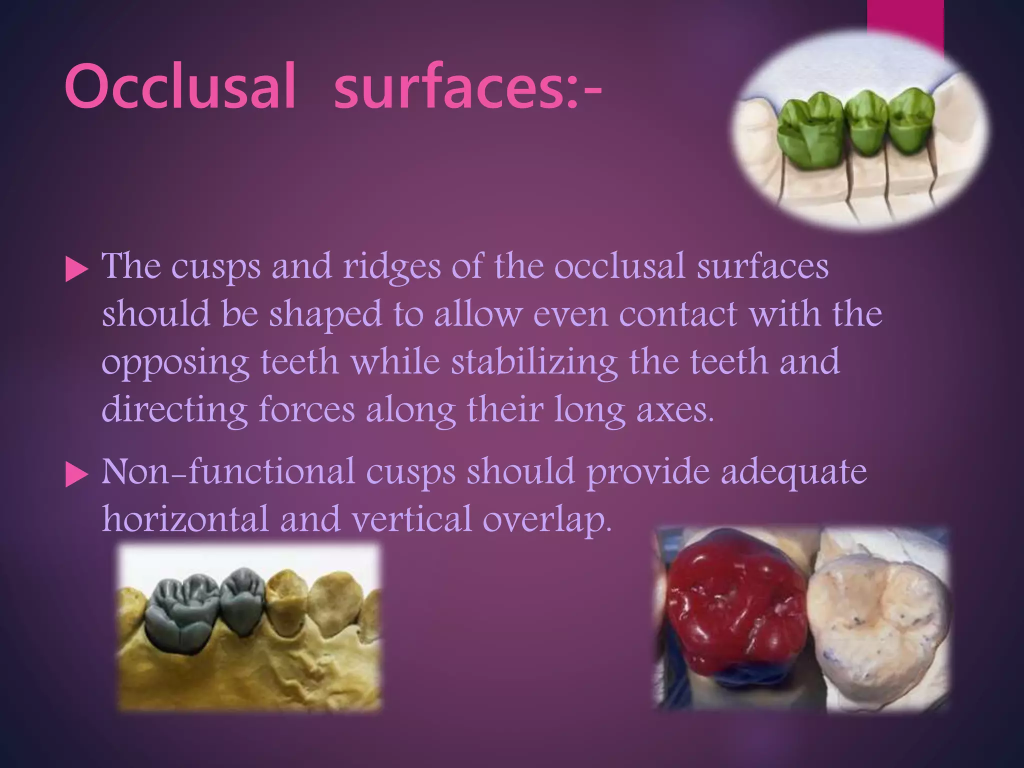 Wax patterns fabrication for fixed partial dentures | PPTX