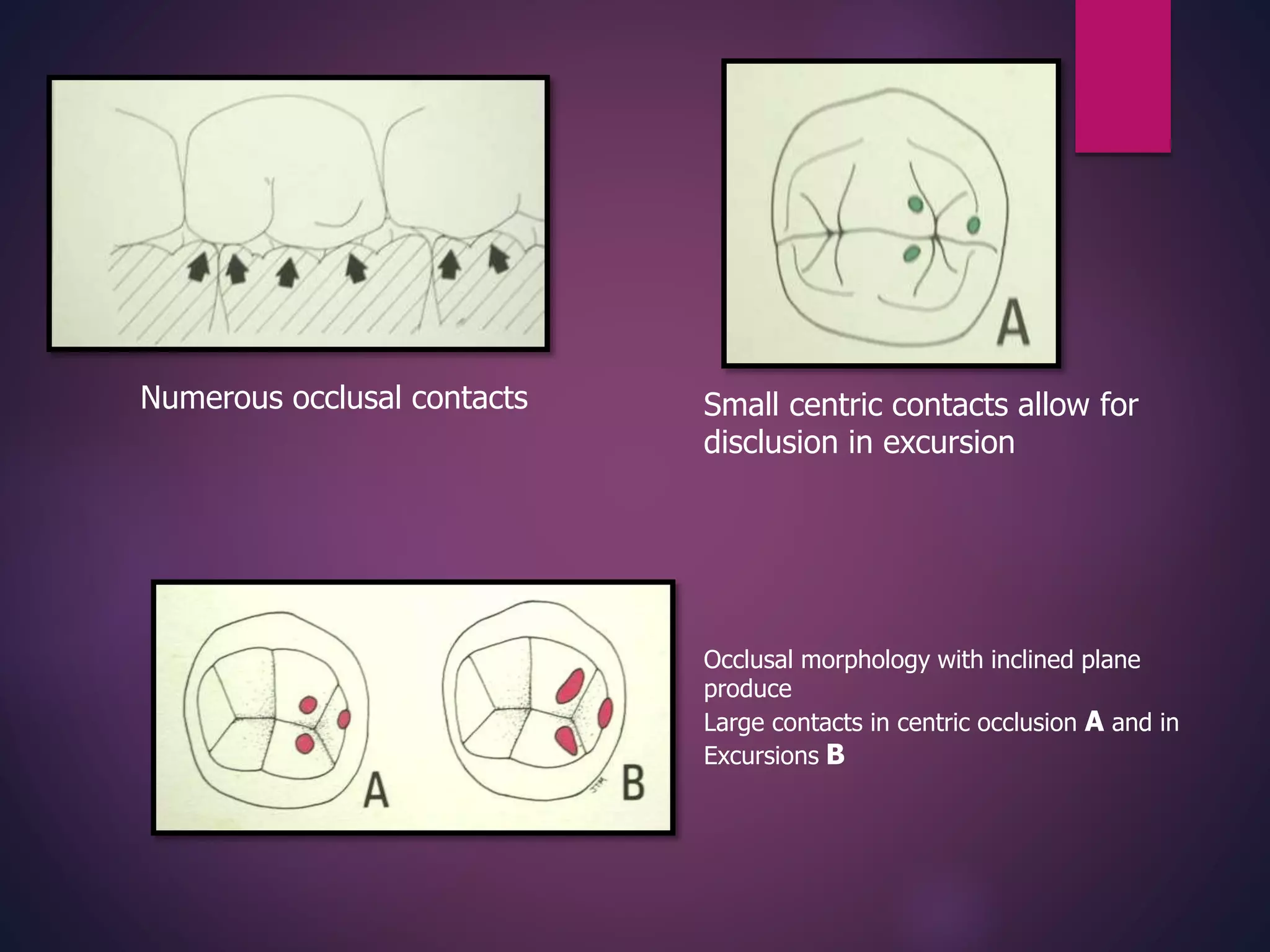 Wax patterns fabrication for fixed partial dentures | PPTX