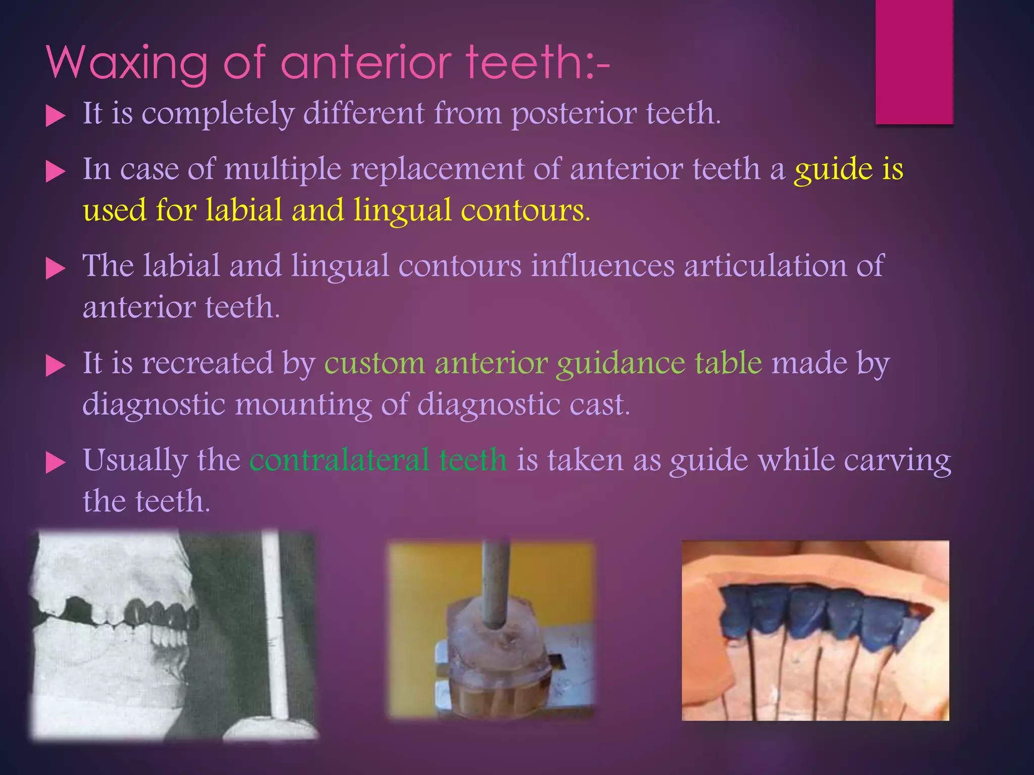 Wax patterns fabrication for fixed partial dentures | PPTX