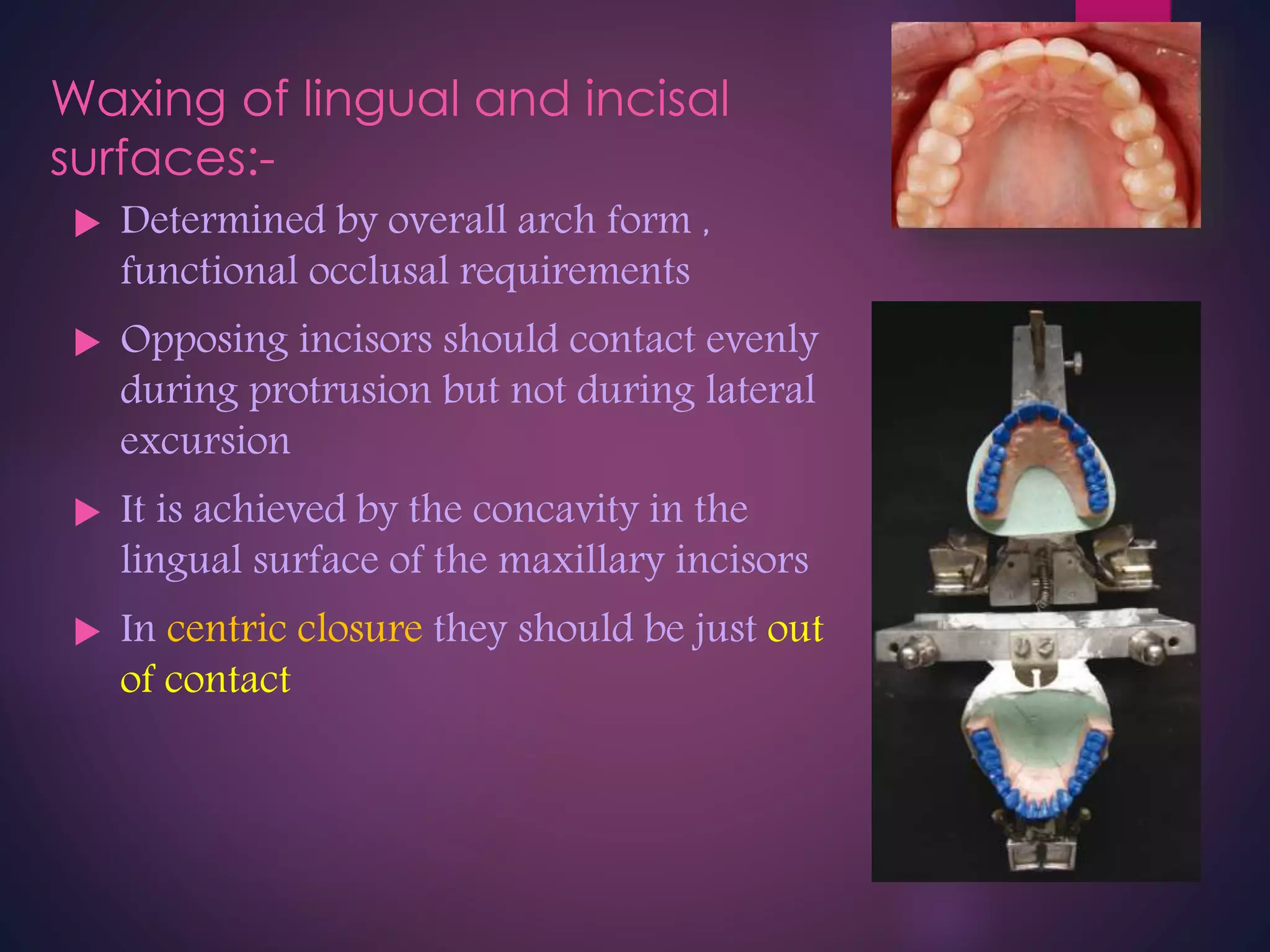 Wax patterns fabrication for fixed partial dentures | PPTX