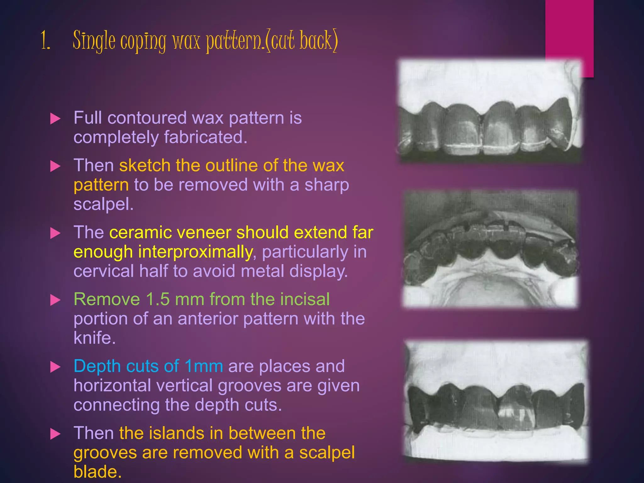 Wax patterns fabrication for fixed partial dentures | PPTX