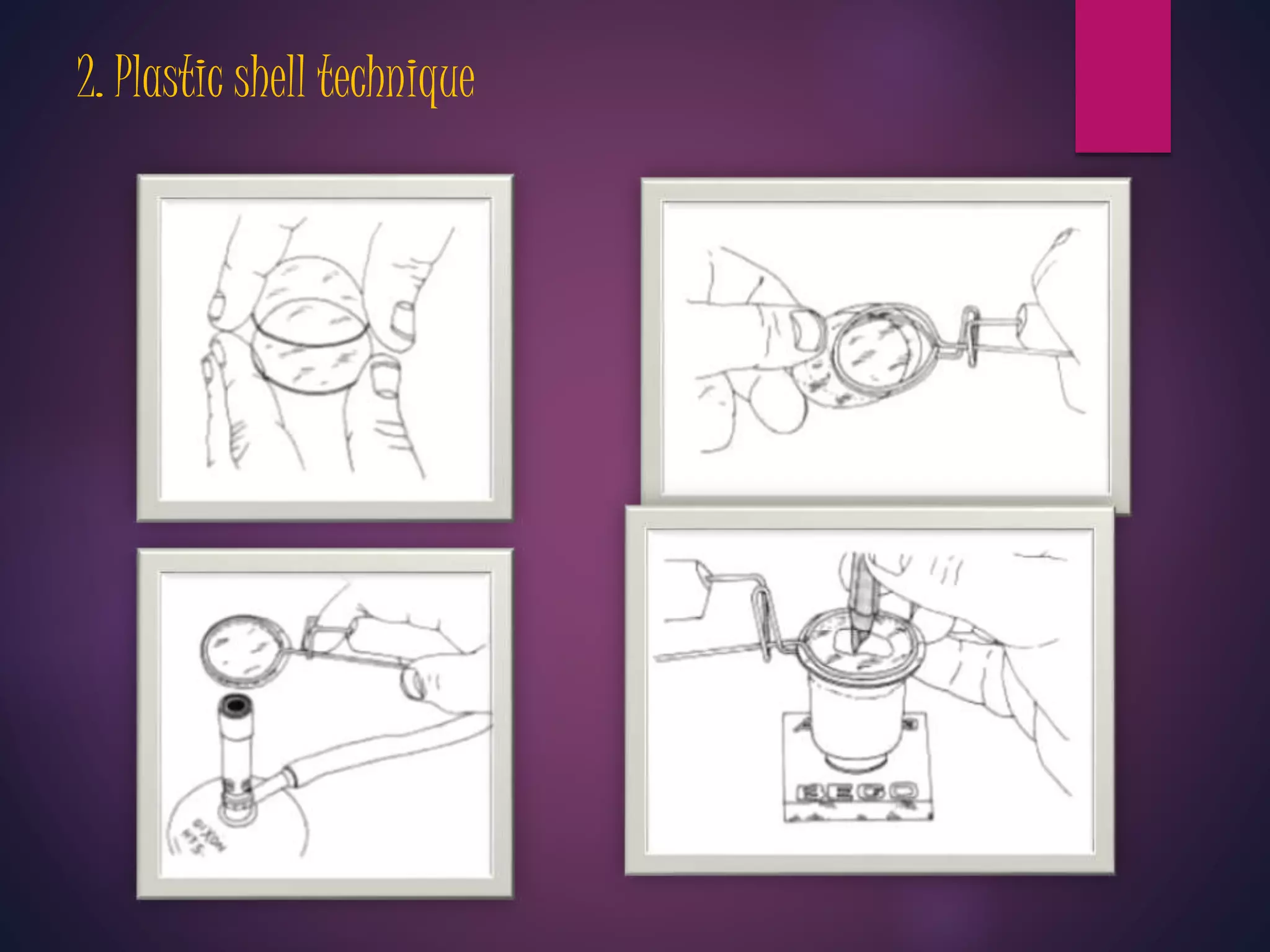 Wax patterns fabrication for fixed partial dentures | PPTX