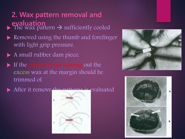 Wax patterns fabrication for fixed partial dentures | PPTX | Oral care ...