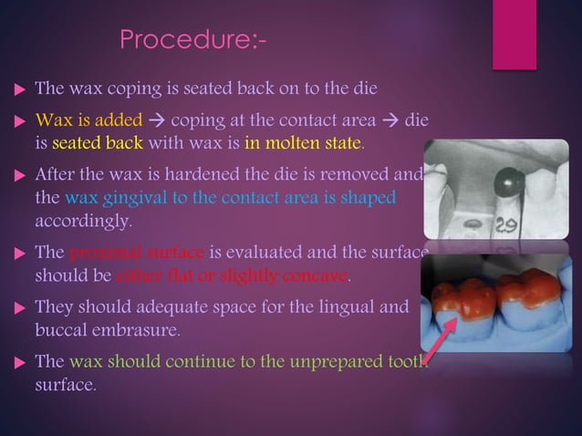 Wax patterns fabrication for fixed partial dentures | PPTX | Oral care ...