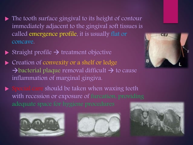 Wax patterns fabrication for fixed partial dentures | PPTX | Oral care ...