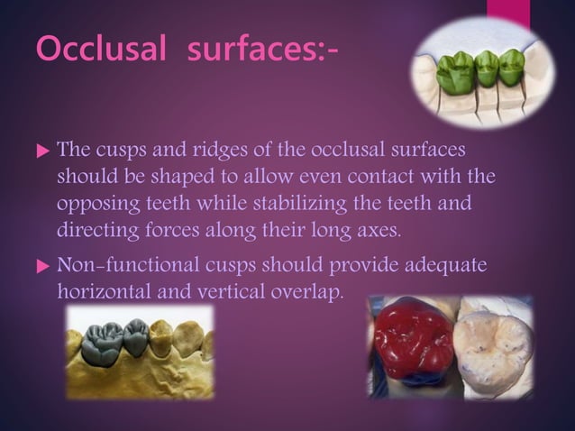 Wax patterns fabrication for fixed partial dentures | PPTX | Oral care ...