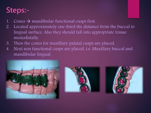Wax patterns fabrication for fixed partial dentures | PPTX | Oral care ...