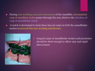 Wax patterns fabrication for fixed partial dentures | PPTX