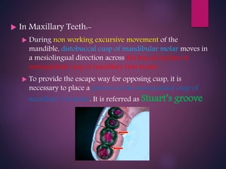Wax patterns fabrication for fixed partial dentures | PPTX