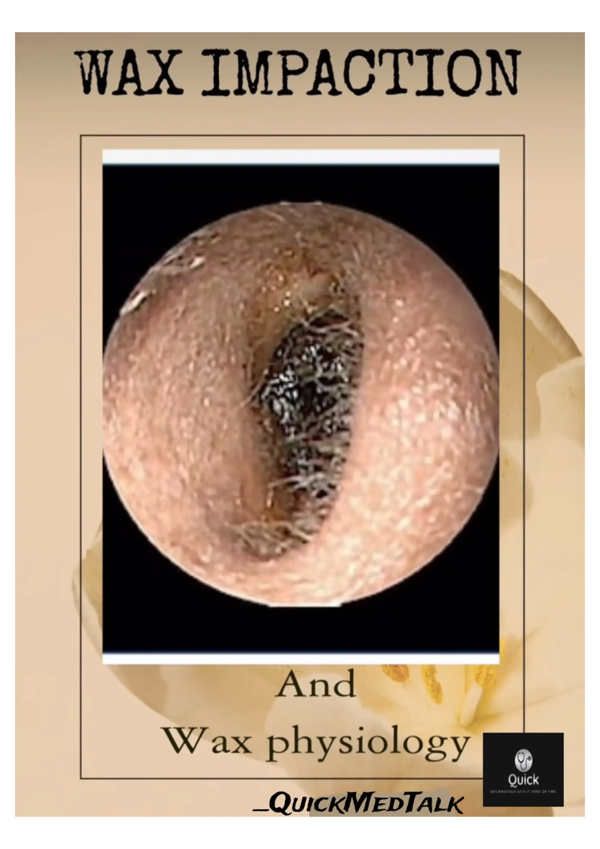 Wax physiology and Wax impaction .pdf ENT BY QUICKMEDTALK | PDF