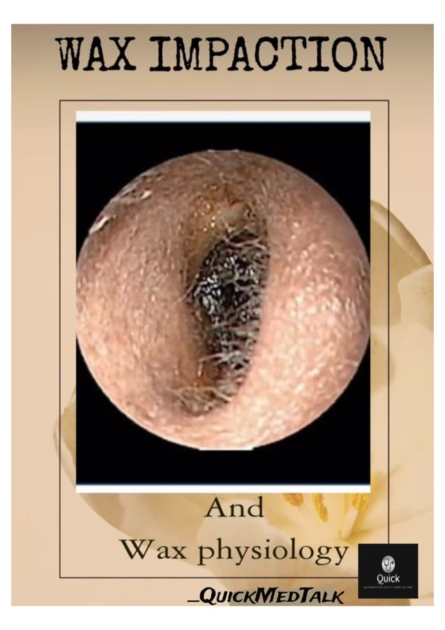 Wax physiology and Wax impaction .pdf ENT BY QUICKMEDTALK | PDF