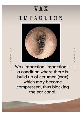 Wax physiology and Wax impaction .pdf ENT BY QUICKMEDTALK | PDF