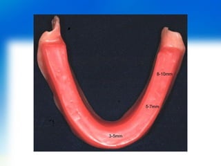 Wax rims & jaw relations | PDF