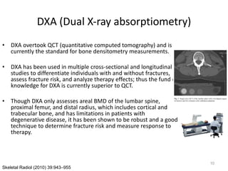 Way+forward+in+osteoporosis%3aa+disease+which+is+no+longer+silent | PPT