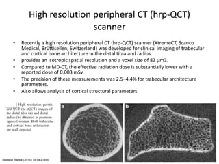 Way+forward+in+osteoporosis%3aa+disease+which+is+no+longer+silent | PPT
