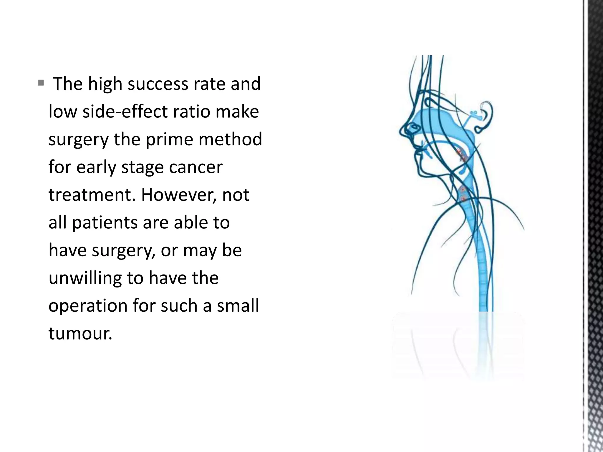 Ways To Treat Early Stage Throat Cancer Ppt