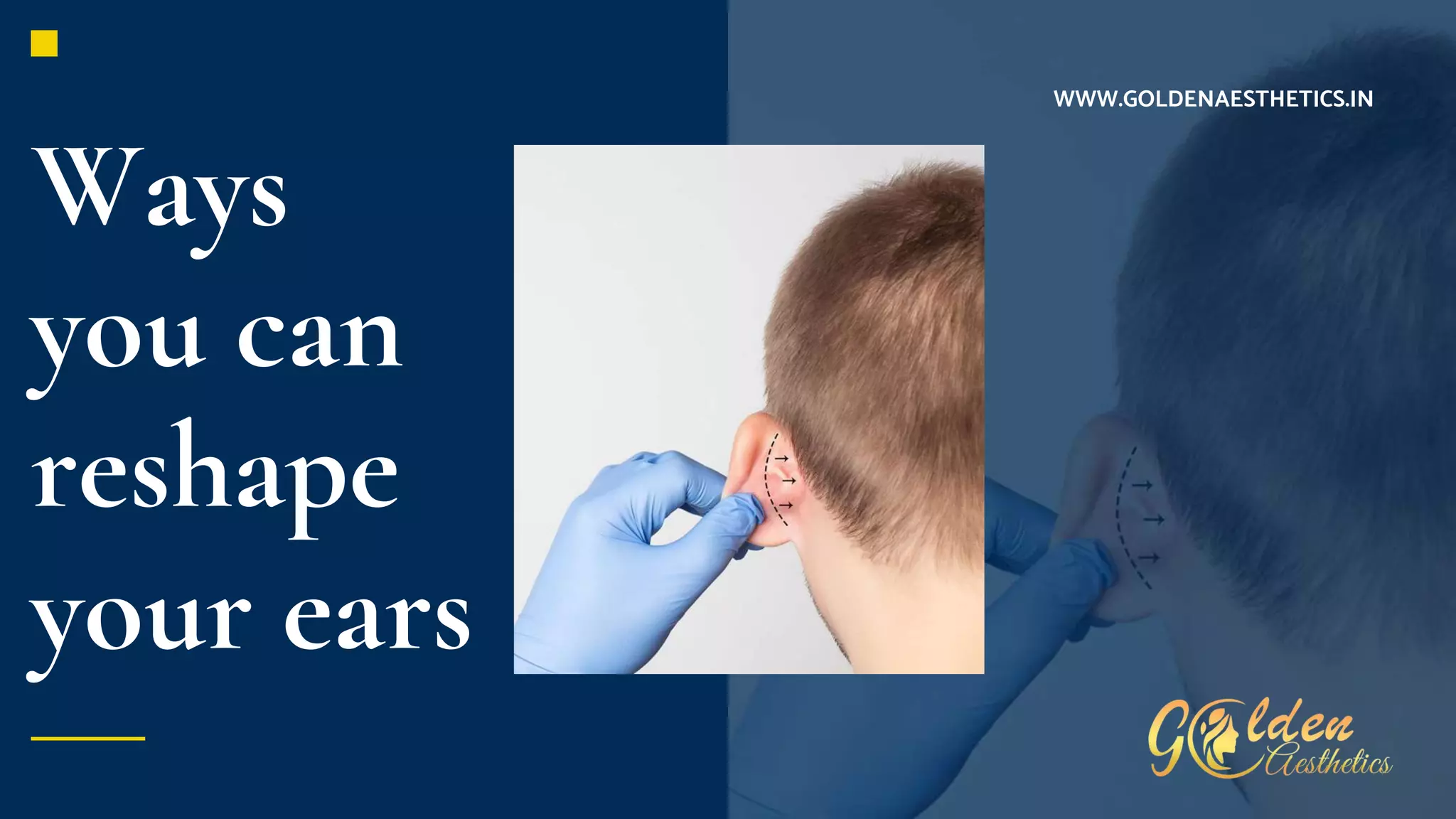 WAYS YOU CAN RESHAPE YOUR EARS | PPTX | Ear, Nose and Throat Conditions ...