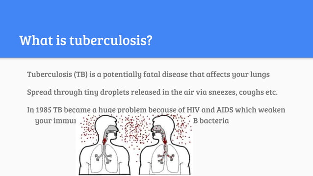 Turberculosis | PPT