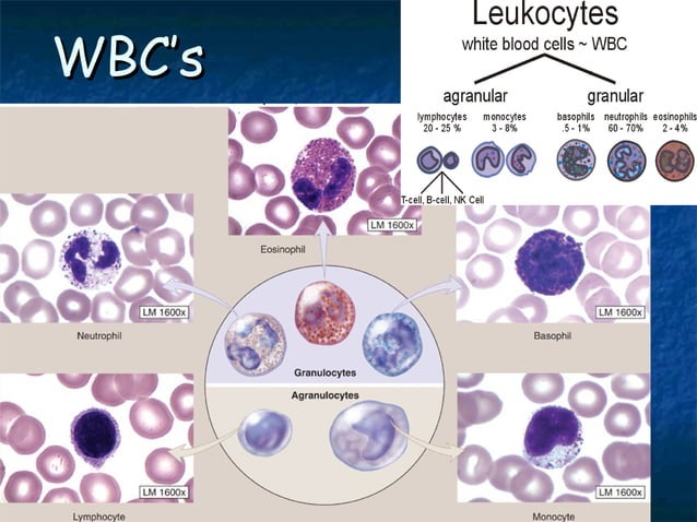 Leukocytosis. Leukopenia. Leukosis | PPT