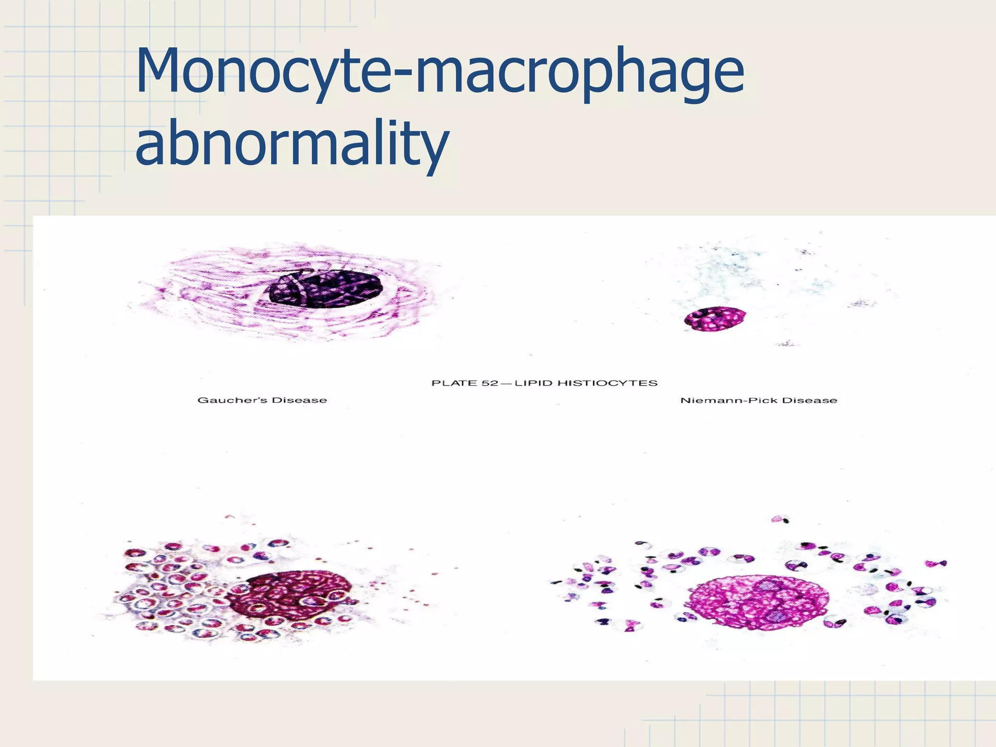 WBC Abnormalities.ppt.pdf | Blood Disorders | Diseases and Conditions