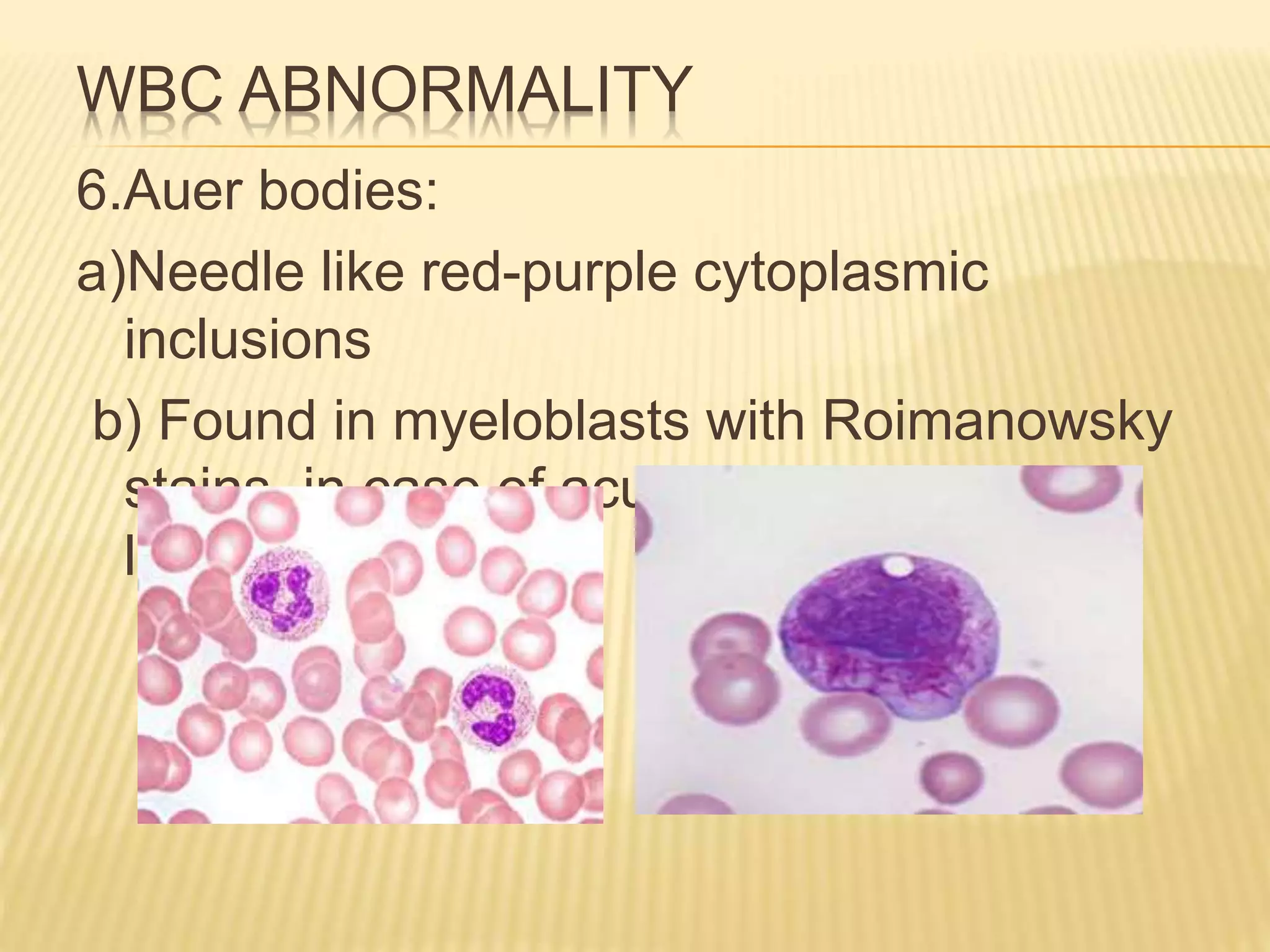 Wbc abnormality | PPTX