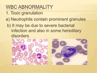 Wbc abnormality | PPTX